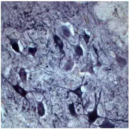 Choline Acetyltransferase IHC: ChAT Markers Useful in Neuron Studies ...