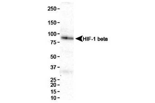 HIF-1 Beta: Partner of HIF-1 Alpha for Adaptive Response to Hypoxia ...