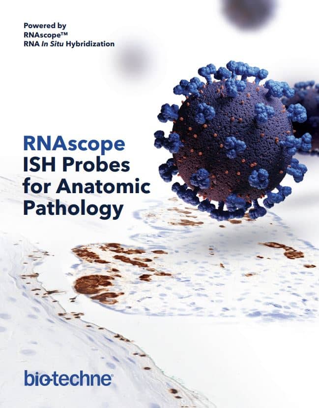 RNAscope ISH Probes for Anatomic Pathology | Bio-Techne