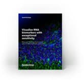 RNAscope™ Multiplex Fluorescent V2 assay with New TSA Vivid™ Dyes ...