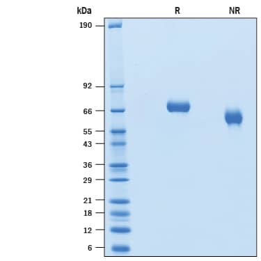 Recombinant Human MuSK His-tag Protein, CF (10189-MK) by R&D Systems ...