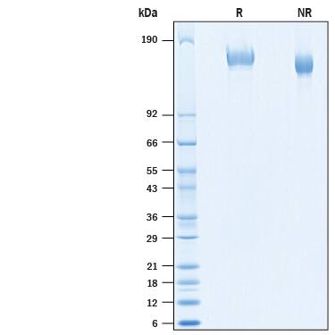 Recombinant SARS-CoV-2 B.1.1.7 Spike His-tag Protein, CF (10748-CV) by R&D Systems, Part of Bio ...