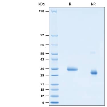 Recombinant SARS-CoV-2 S494P Spike RBD His-tag Protein, CF (10789-CV) by R&D Systems, Part of ...