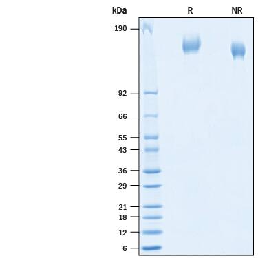 Recombinant SARS-CoV-2 +E484K B.1.1.7 Spike GCN4-IZ Protein (10824-CV) by R&D Systems, Part of ...