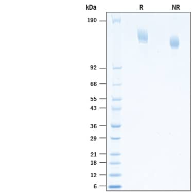 Recombinant SARS-CoV-2 +S494P B.1.1.7 Spike GCN4-IZ Protein (10854-CV) by R&D Systems, Part of ...