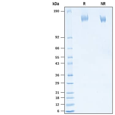 Recombinant SARS-CoV-2 B.1.324.1 Spike (GCN4-IZ) Protein, CF (10873-CV) by R&D Systems, Part of ...