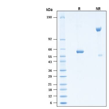Recombinant SARS-CoV-2 B.1.617.2 Spike RBD Fc Protein, CF (10901-CV) by R&D Systems, Part of Bio ...