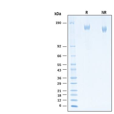Recombinant SARS-CoV-2 P.2 Spike (GCN4-IZ) His Protein, CF (11108-CV) by R&D Systems, Part of ...
