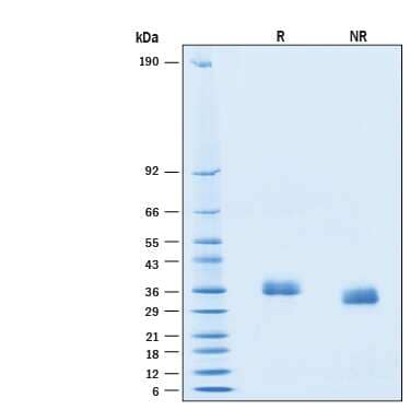 Recombinant SARS-CoV-2 BA.4/BA.5 RBD His-tag Protein, CF (11229-CV) by R&D Systems, Part of Bio ...