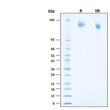 Recombinant SARS-CoV-2 BA.4/BA.5 S GCN4-IZ His Protein, CF (11231-CV) by R&D Systems, Part of ...