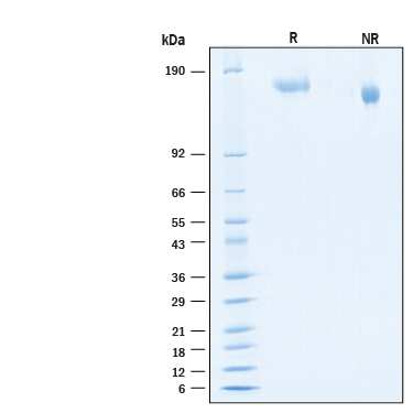 Recombinant SARS-CoV-2 BA.4/BA.5 Spike His-tag Protein, CF (11232-CV) by R&D Systems, Part of ...
