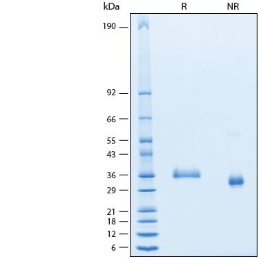 Recombinant SARS-CoV-2 BA.2.75 Spike RBD His-tag Protein, CF (11259-CV) by R&D Systems, Part of ...