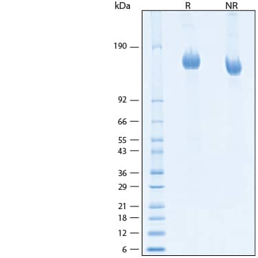 Recombinant SARS-CoV-2 BA.4.6 Spike GCN4-IZ His Protein, CF (11286-CV) | Bio-Techne