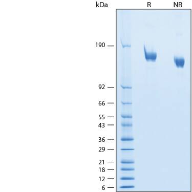 Recombinant SARS-CoV-2 BA.2.12.1 S GCN4-IZ His Protein, CF (11287-CV) by R&D Systems, Part of ...