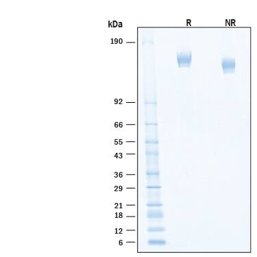 Recombinant SARS-CoV-2 BQ.1.1 Spike GCN4-IZ His Protein, CF (11359-CV) | Bio-Techne