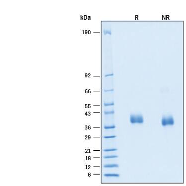 Recombinant SARS-CoV-2 BA.2.86 Spike RBD His-tag Protein, CF (11440-CV) by R&D Systems, Part of ...