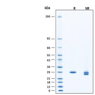 Recombinant S. cerevisiae SUMO Protease ULP1 His Protein, CF (11697-SO ...