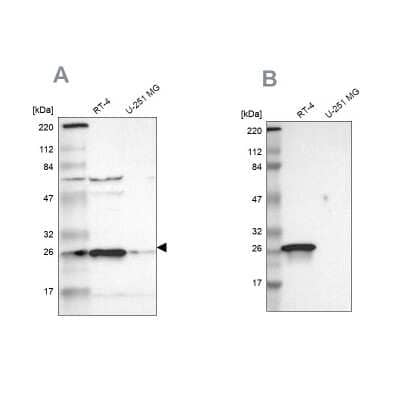15-PGDH/HPGD Antibody (NBP1-87062) | Bio-Techne