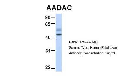 AADAC Antibody (NBP1-62428) | Bio-Techne