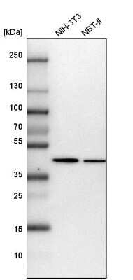 ADE2 Antibody (NBP1-90235) | Bio-Techne