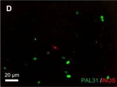 ANP32B Antibody (NB100-1199) by Novus, Part of Bio-Techne