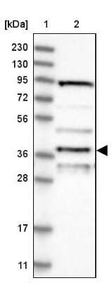 APOL6 Antibody (NBP1-89031) by Novus, Part of Bio-Techne