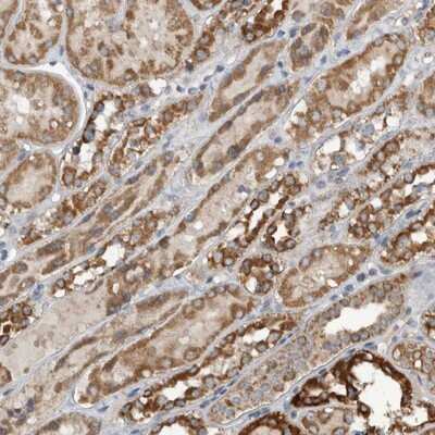 ARMC1 Antibody - BSA Free (NBP1-88847) by Novus, Part of Bio-Techne