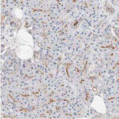 Adipolin/FAM132A Antibody - BSA Free (NBP1-90700) by Novus, Part of Bio ...