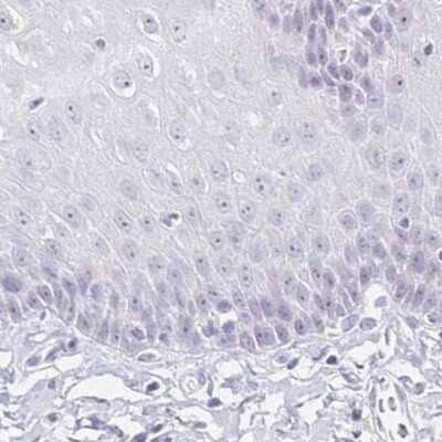 Aggrecan Antibody - BSA Free (NBP2-55539) by Novus, Part of Bio-Techne