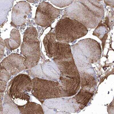 AlphaB Crystallin/CRYAB Antibody - BSA Free (NBP2-49246) by Novus, Part ...