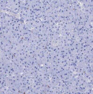 AlphaB Crystallin/CRYAB Antibody - BSA Free (NBP2-49246) by Novus, Part ...