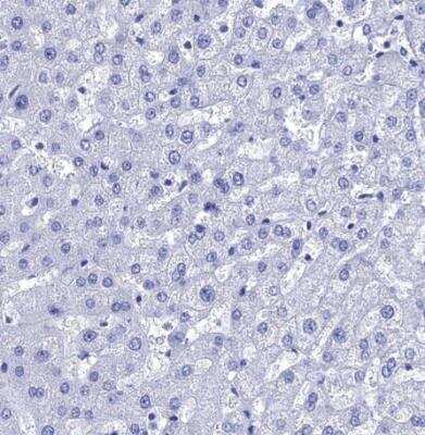 AlphaB Crystallin/CRYAB Antibody - BSA Free (NBP2-49246) by Novus, Part ...