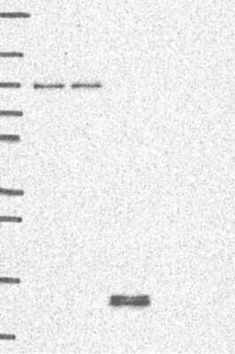 Apolipoprotein CIII Antibody (NBP3-17685) | Bio-Techne
