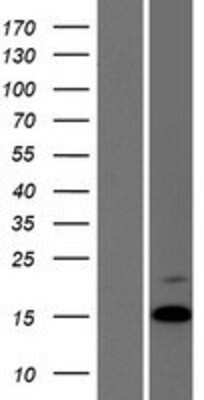 Antidiuretic Hormone Overexpression Lysate (NBP2-10674) by Novus, Part ...