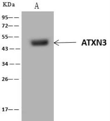 Ataxin-3 Antibody - BSA Free (NBP3-12686) by Novus, Part of Bio-Techne