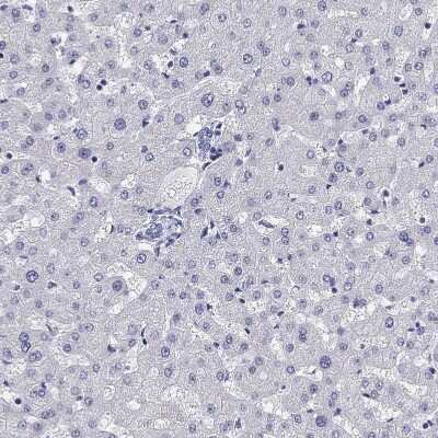 BAD-LAMP/LAMP5 Antibody - BSA Free (NBP1-84246) by Novus, Part of Bio ...