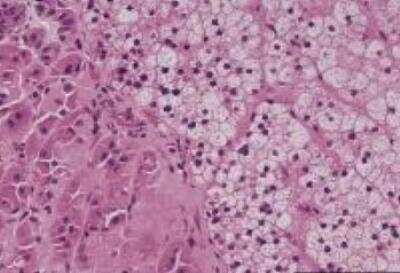 Adrenal normal tissue Products | Bio-Techne