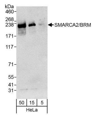 BRM Antibody (NB100-55309) by Novus, Part of Bio-Techne