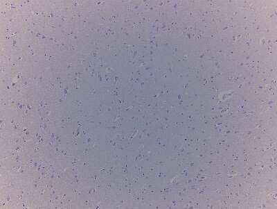 Brain Amygdala Products