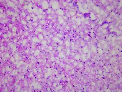 Brain Amygdala Products