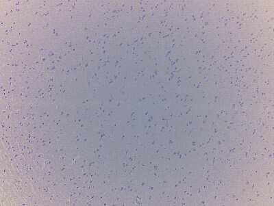 Brain Cerebral Cortex Tissue Slides (Adult Normal)- Paraffin (NBP2 ...