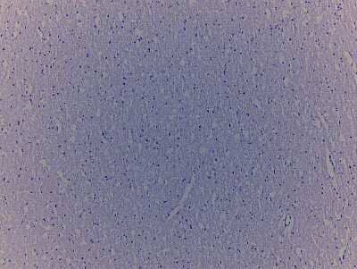 Brain Insula Tissue Slides (Adult Normal)- Paraffin (NBP2-77763) by ...