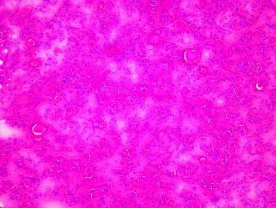 Brain Pituitary Tissue Slides (Alzheimer's)- Frozen (NBP2-77602) by ...