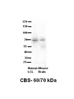 CBS Antibody (NBP1-52850) | Bio-Techne