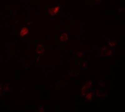 CCDC22 Antibody - BSA Free (NBP2-81708) | Bio-Techne