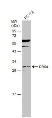 CDK4 Antibody (NBP1-31308) by Novus, Part of Bio-Techne