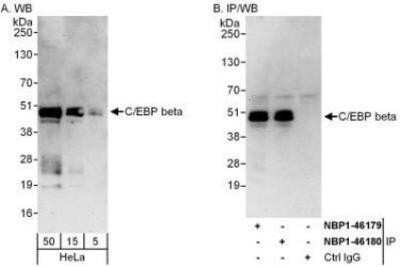 CEBP Beta Antibody - BSA Free (NBP1-46179) by Novus, Part of Bio-Techne