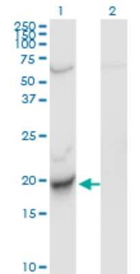 CENPM Antibody (4C12-2C8) (H00079019-M01) | Bio-Techne