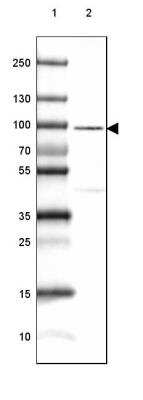 CRTAC1 Antibody - BSA Free (NBP1-88864) by Novus, Part of Bio-Techne