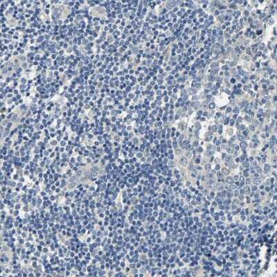 Centaurin alpha 1 Antibody (NBP1-88098) | Bio-Techne